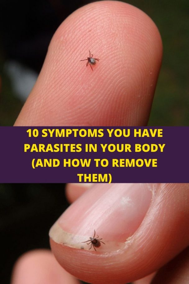 10 SYMPTOMS YOU HAVE PARASITES IN YOUR BODY (AND HOW TO REMOVE THEM ...
