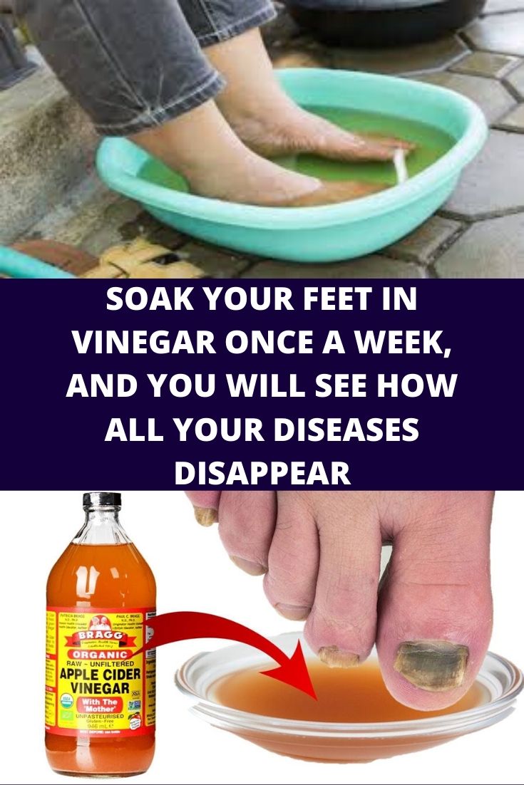 SOAK YOUR FEET IN VINEGAR ONCE A WEEK, AND YOU WILL SEE HOW ALL YOUR ...