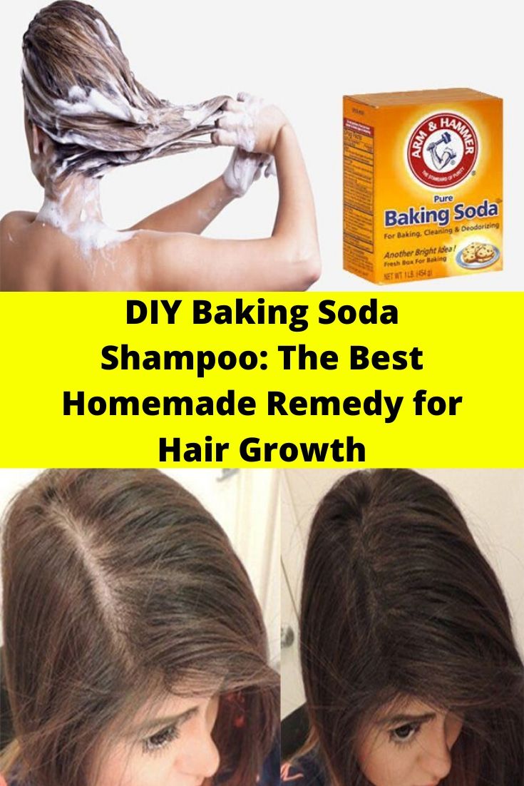 DIY Baking Soda Shampoo: The Best Homemade Remedy for Hair Growth ...