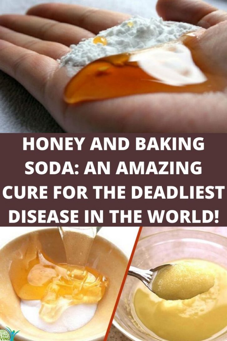 HONEY AND BAKING SODA: AN AMAZING CURE FOR THE DEADLIEST DISEASE IN THE ...