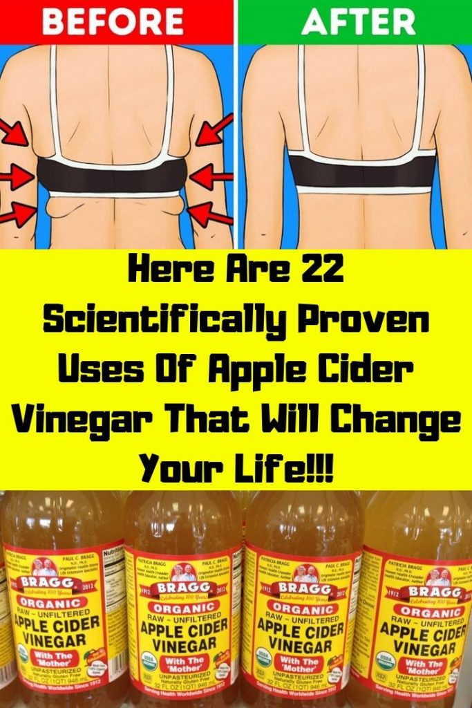 Here Are 22 Scientifically Proven Uses Of Apple Cider Vinegar That Will ...