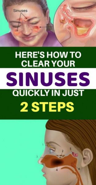 Here’s How to Clear Your Sinuses Quickly In Just Two Steps – Yoga4daily