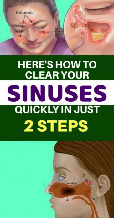Here’s How to Clear Your Sinuses Quickly In Just Two Steps – Yoga4daily