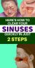 Here’s How to Clear Your Sinuses Quickly In Just Two Steps – Yoga4daily