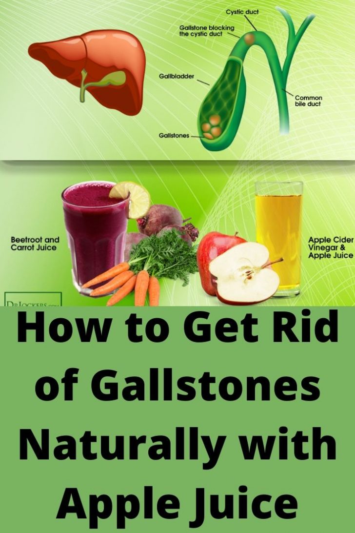 HOW TO GET RID OF GALLSTONES NATURALLY WITH APPLE JUICE – Yoga4daily