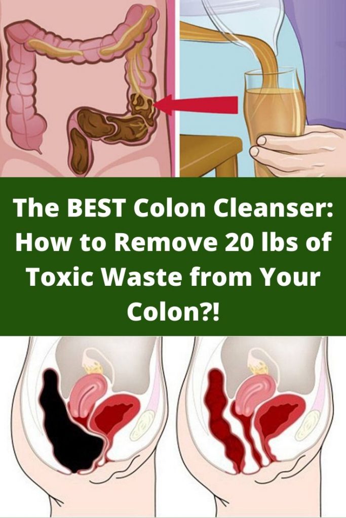 The BEST Colon Cleanser: How to Remove 20 lbs of Toxic Waste from Your ...