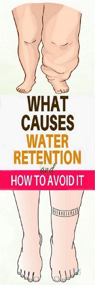 WHAT CAUSES WATER RETENTION AND HOW TO AVOID IT – Yoga4daily