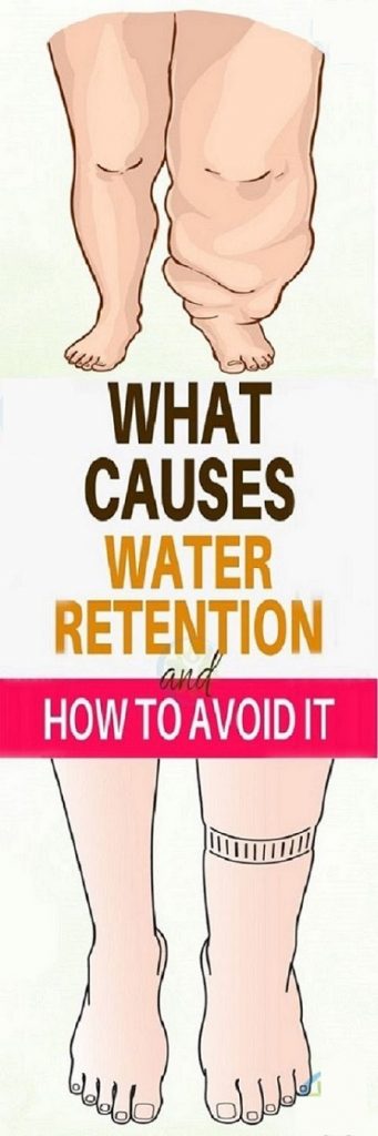 WHAT CAUSES WATER RETENTION AND HOW TO AVOID IT – Yoga4daily